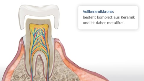 Zahnbehandlung | Allianz Gesundheitswelt
